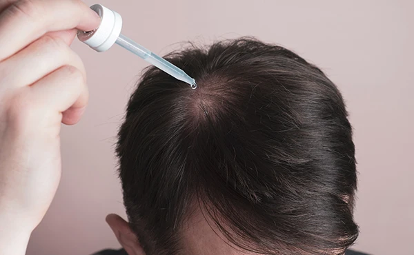 Finasteride for Hair – Benefits & Side Effects | Bergmann Kord